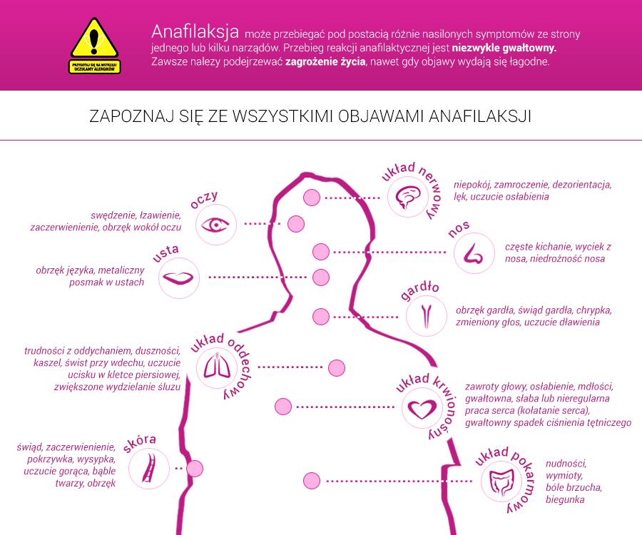 Social Trends : czym-jest-wstrzas-anafilaktyczny.html